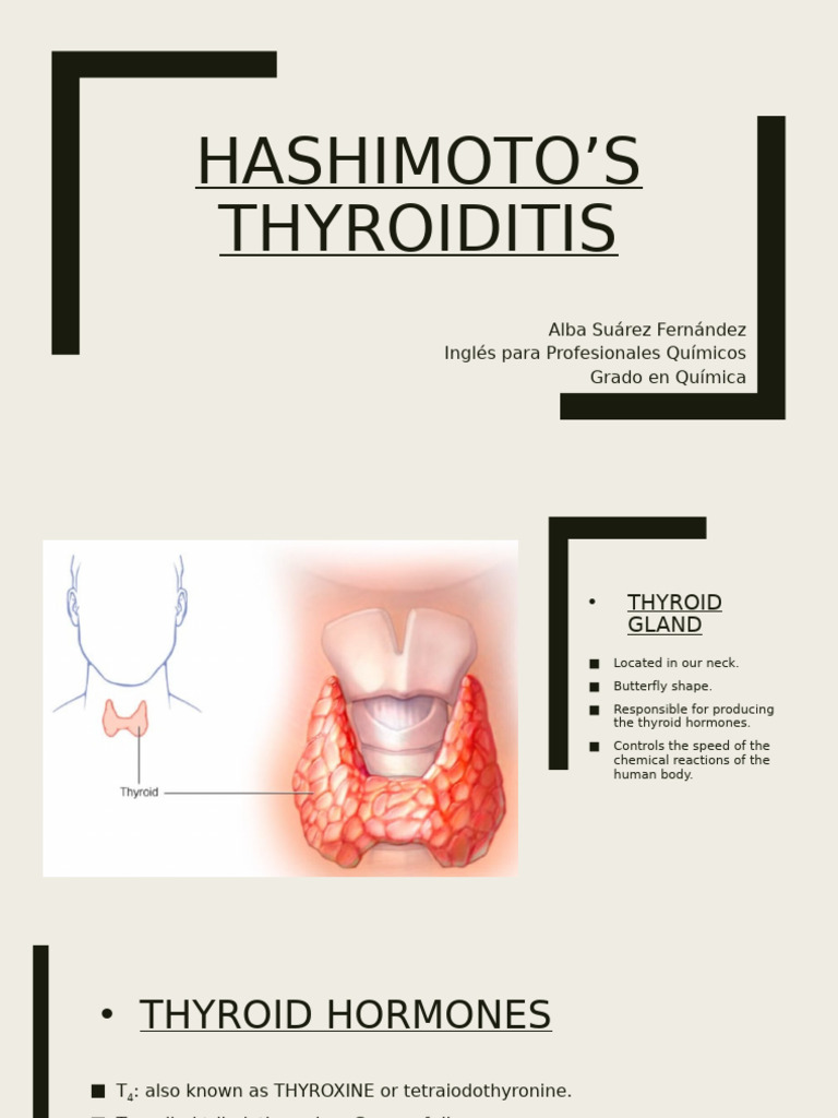 Hashimoto's Thyroiditis | PDF | Self-Improvement | Lifestyle