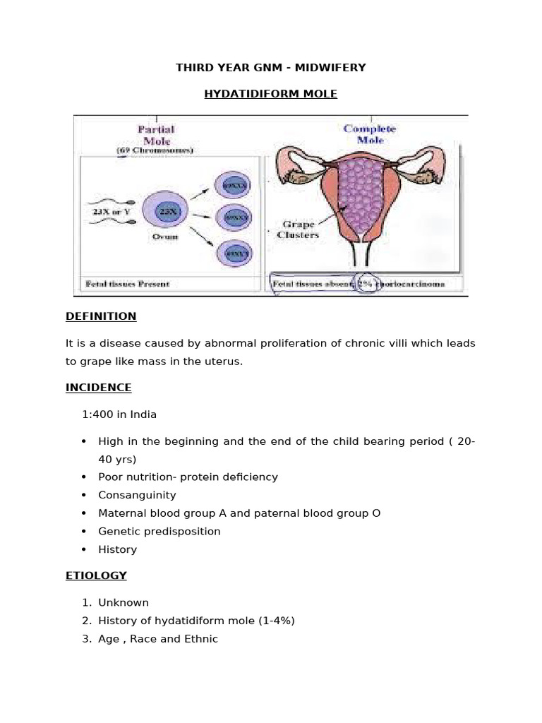 HYDATIDIFORM MOLE | PDF | Diseases And Disorders | Human Reproduction