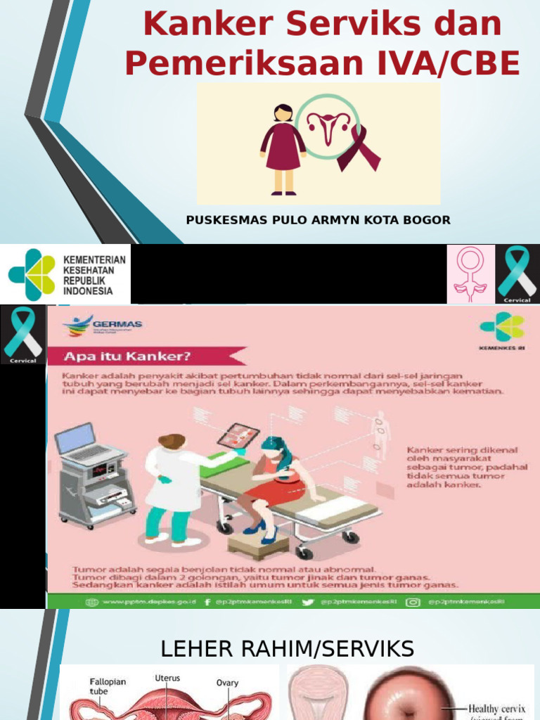 Penyuluhan Kanker Serviks Dan IVA | PDF