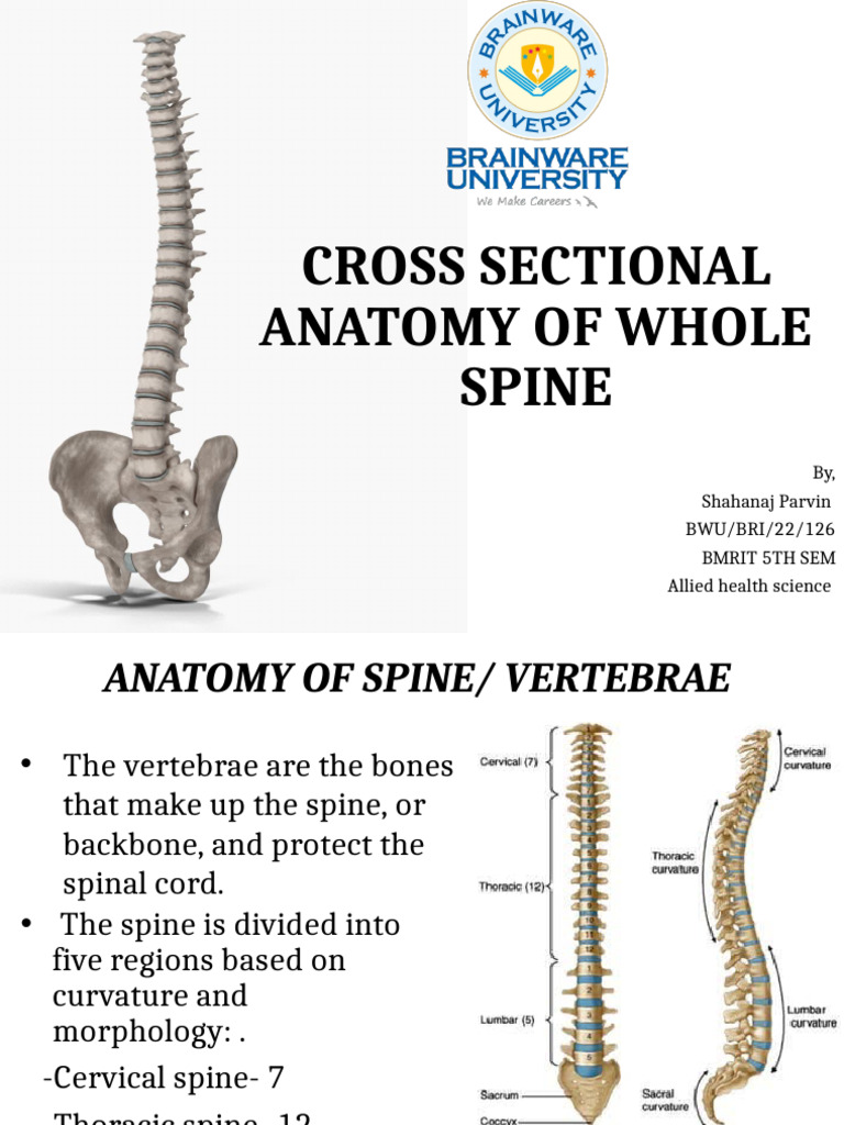 Spine Cross-Sectional Anatomy and Radiological Anatomy | PDF ...