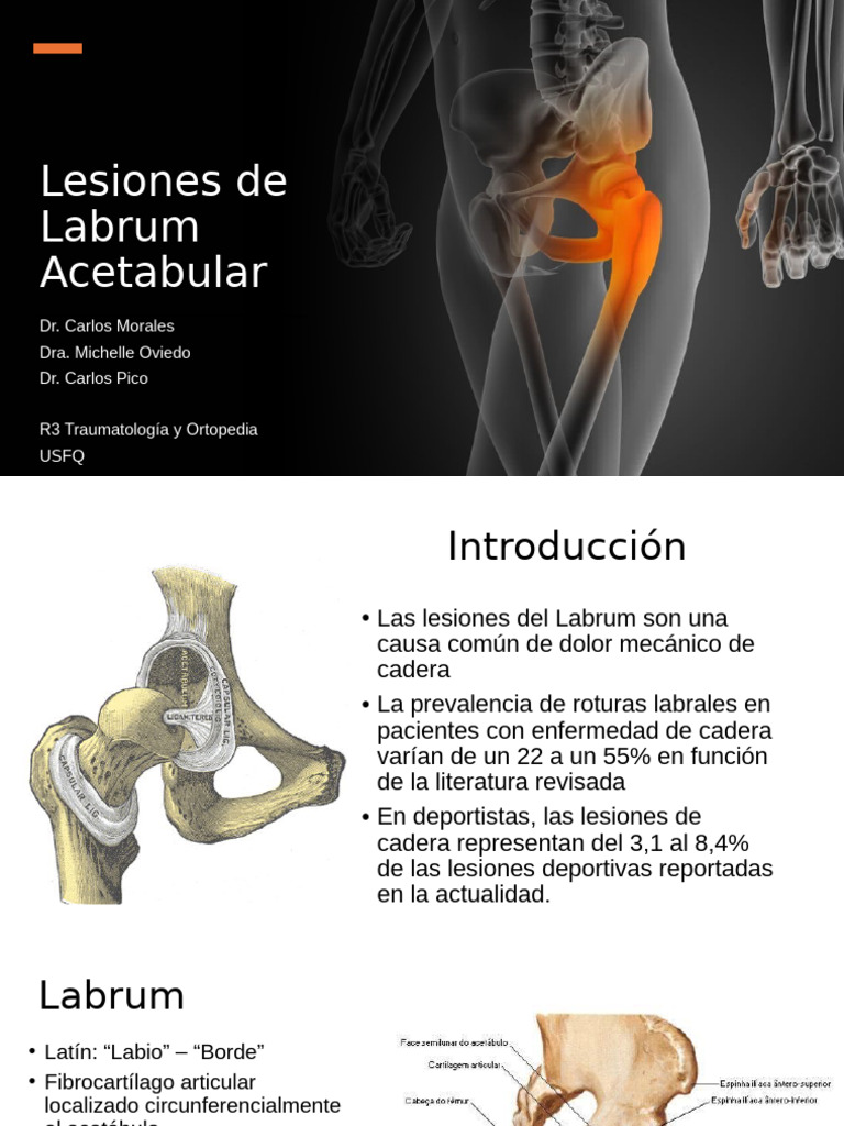 Lesiones de Labrum Acetabular | PDF | Articulación | Sistema esquelético