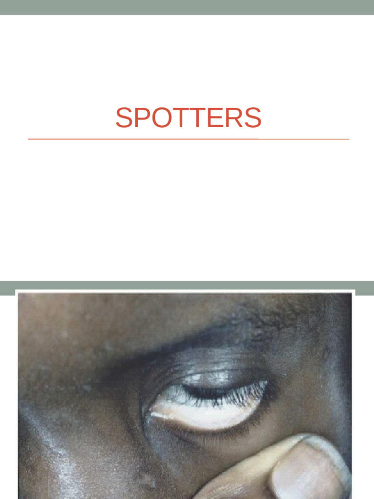 Spotters 2 | PDF