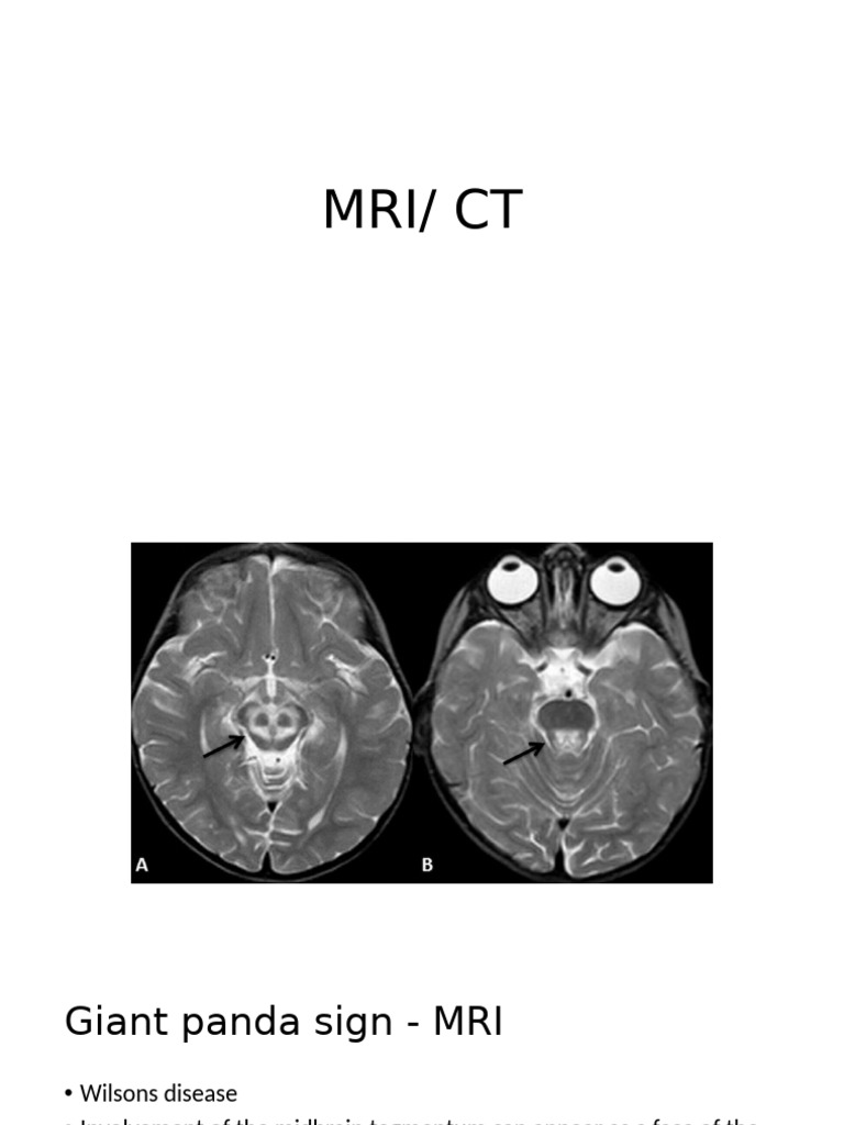 Mri CT | PDF | Social Science | Art