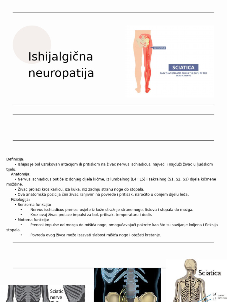 Ishijalgična Neuropatija | PDF