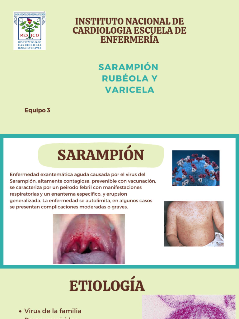 Expo Sarampio Rubeola Y Varicela Pdf Sarampión Virus 9771