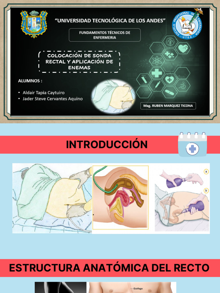 Colocación de Sonda Rectal | PDF