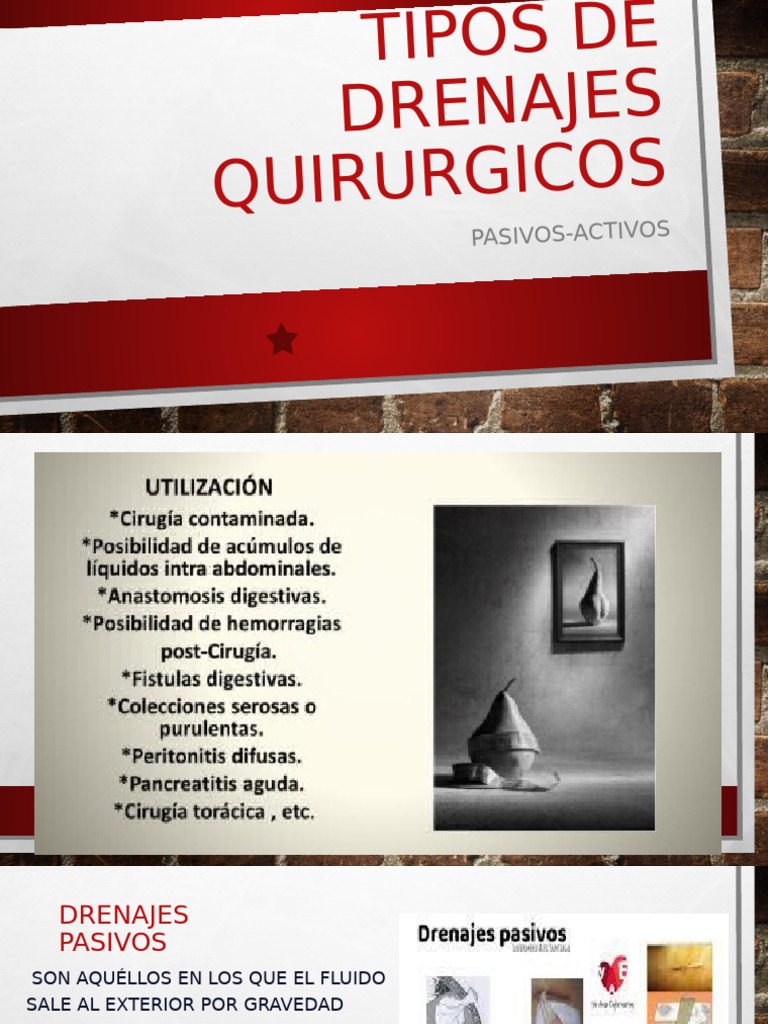 Tipos de Drenajes Quirurgicos | PDF | Medicina CLINICA