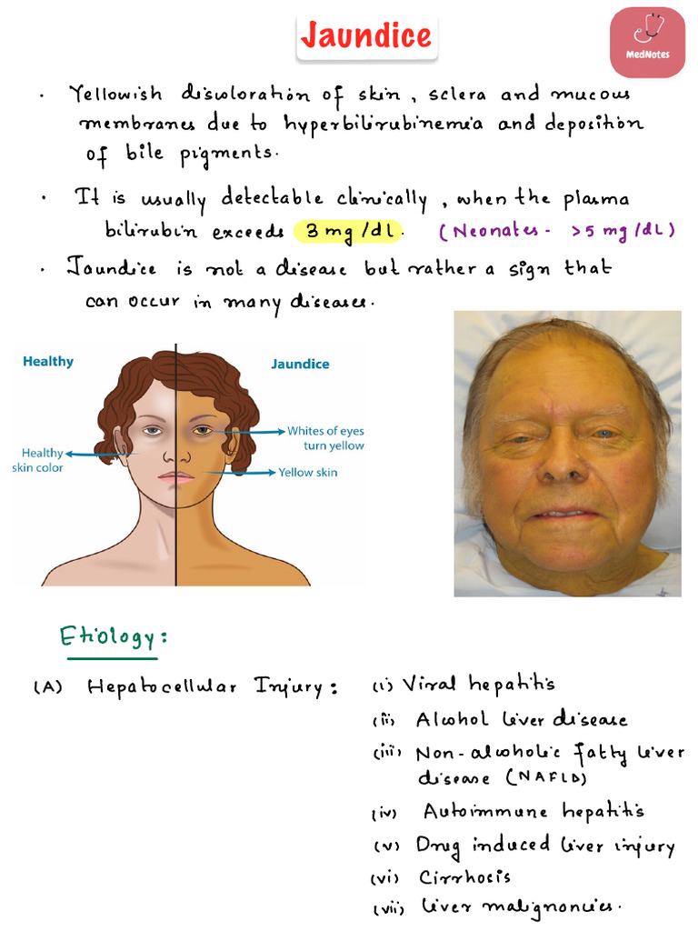 Jaundice | PDF | Diseases And Disorders | Medical Specialties