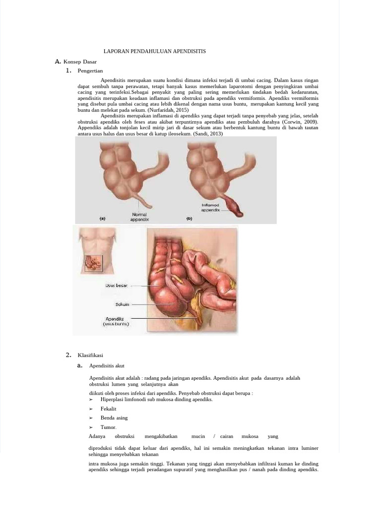 Laporan Pendahuluan Apendisitis | PDF