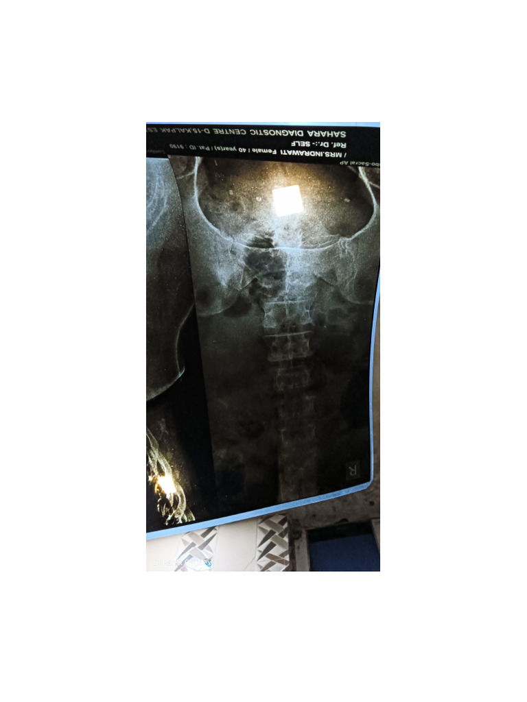 Radiological Assessment of LBP Patient | PDF | Science & Mathematics