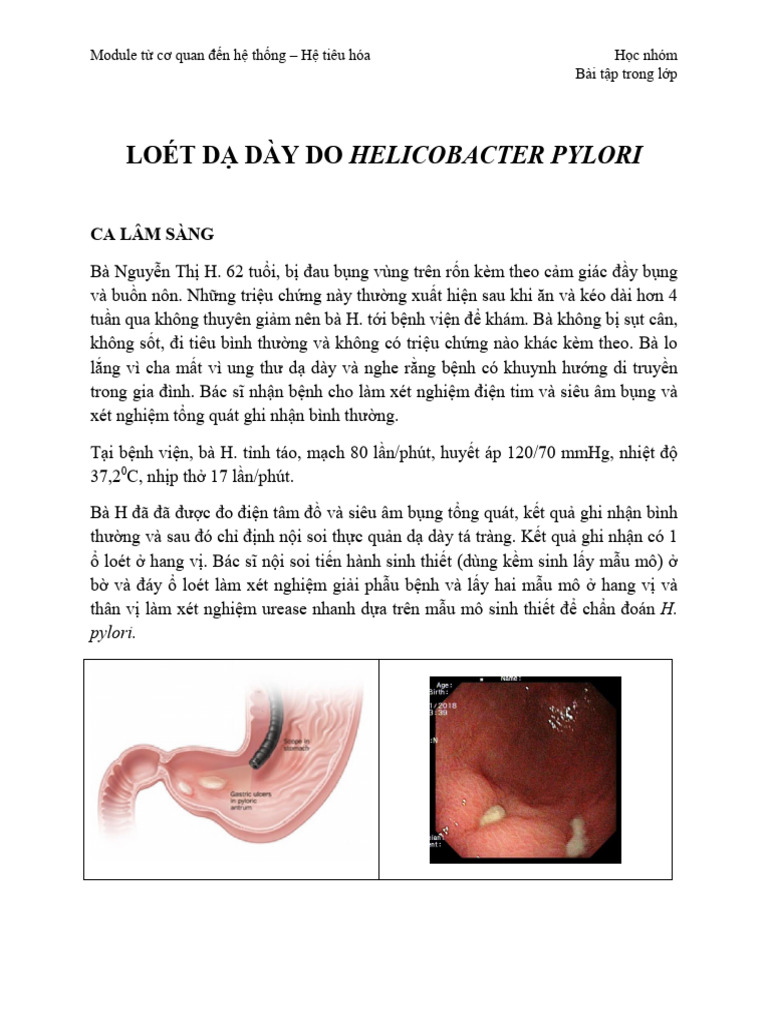 Ca Loet Da Day - Bai Tap Trong Lop | PDF