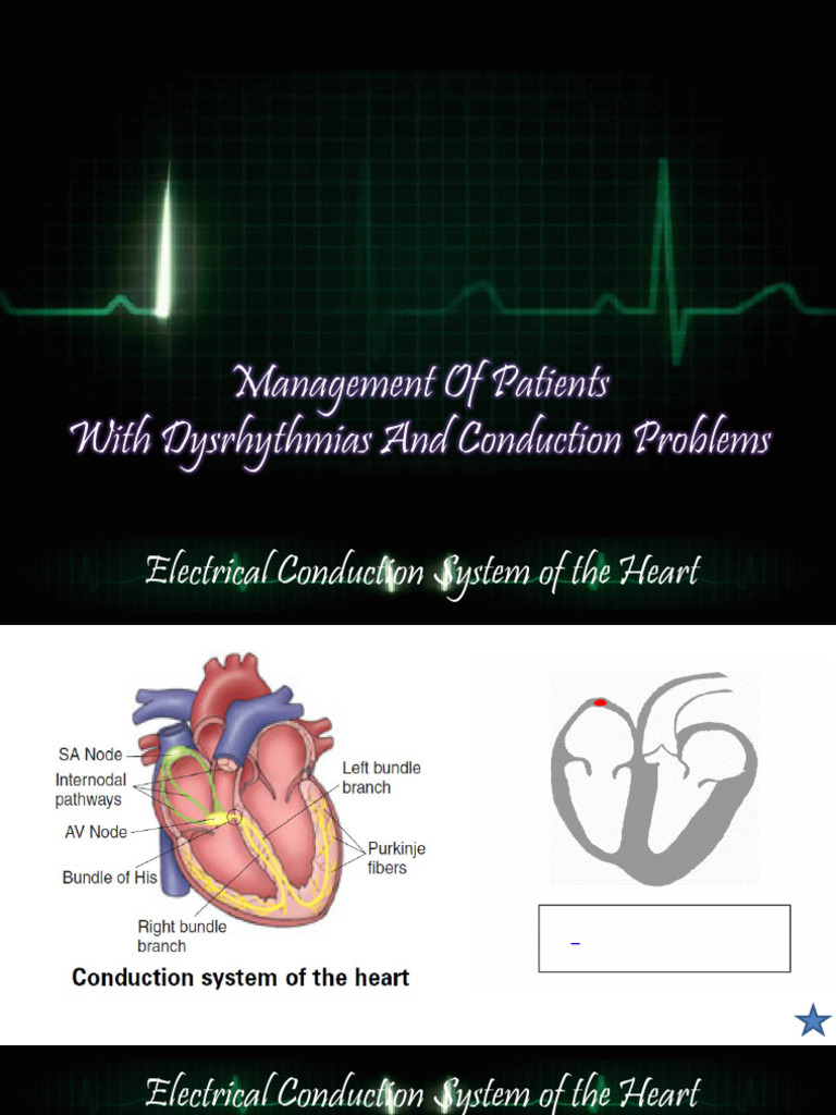 Dysrhythmias and Conduction Problems | PDF | Electrocardiography | Heart