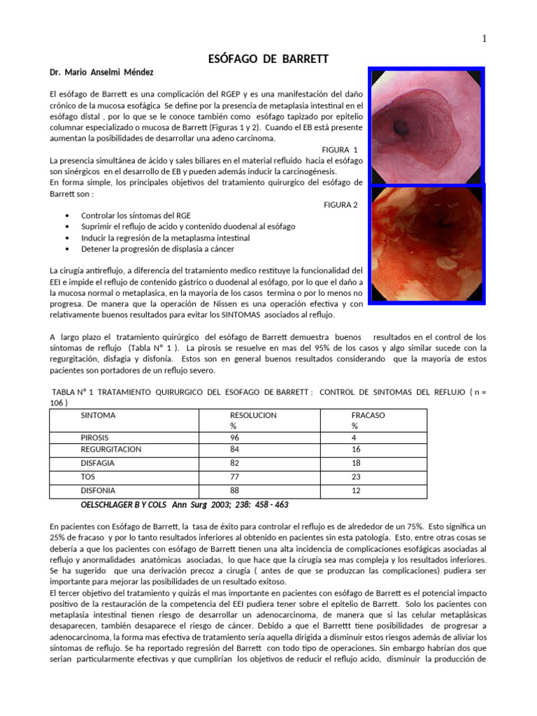 Esofago de Barret I | PDF | La enfermedad por reflujo gastroesofágico ...