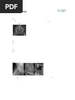 Pelvic X-Ray Views Guide | PDF | Pelvis | Hip