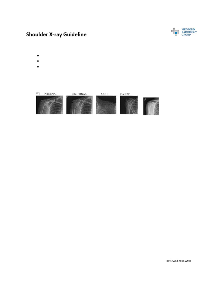 XR Shoulder | PDF