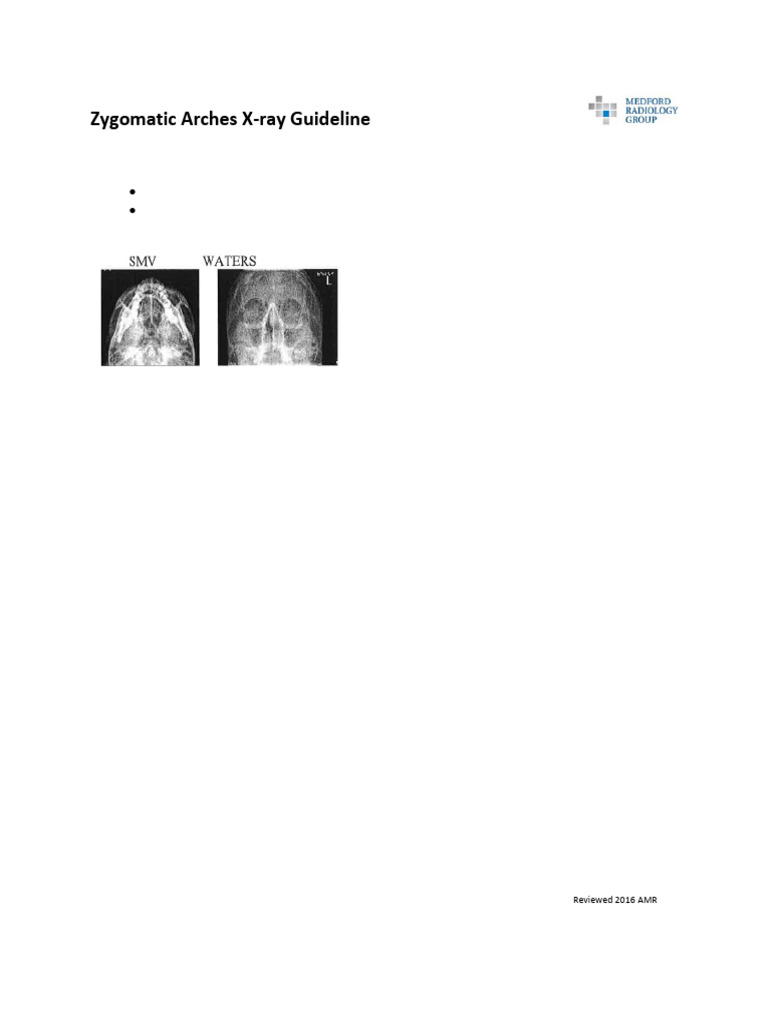 XR Zygomatic Arches | PDF