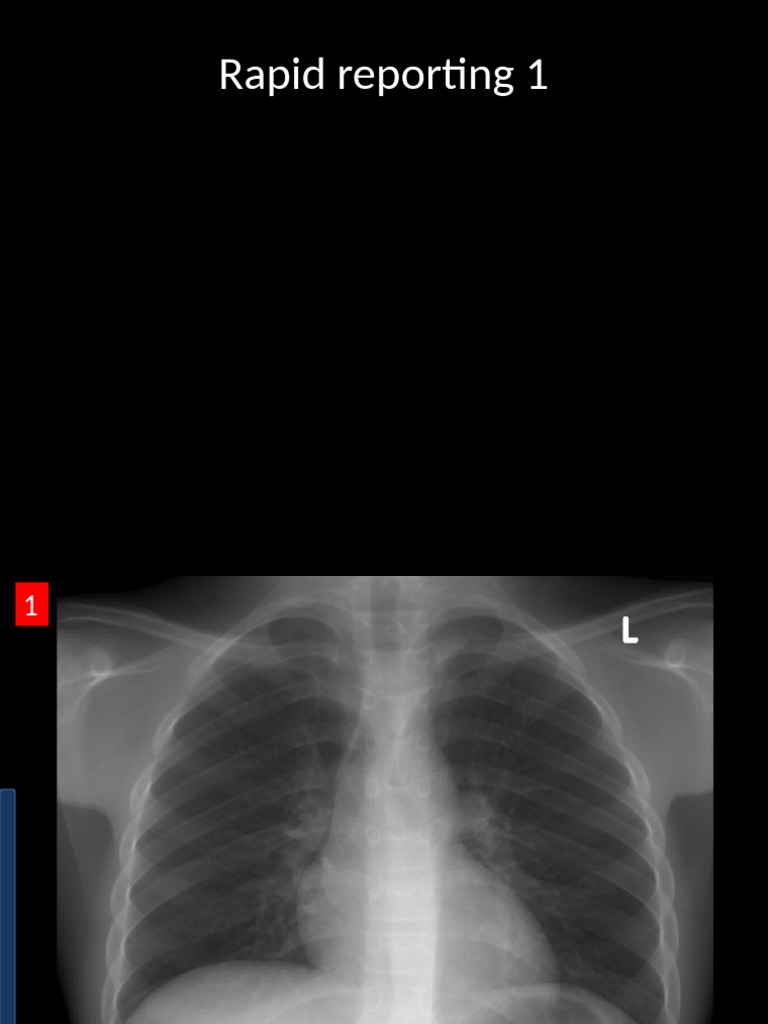 Registrar rapid reporting 1 | PDF | Musculoskeletal System