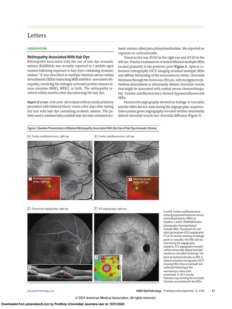 Jamaophthalmology Chirpaz 2024 Lo 240009 1726603874.50536 | PDF | Retina | Visual Acuity