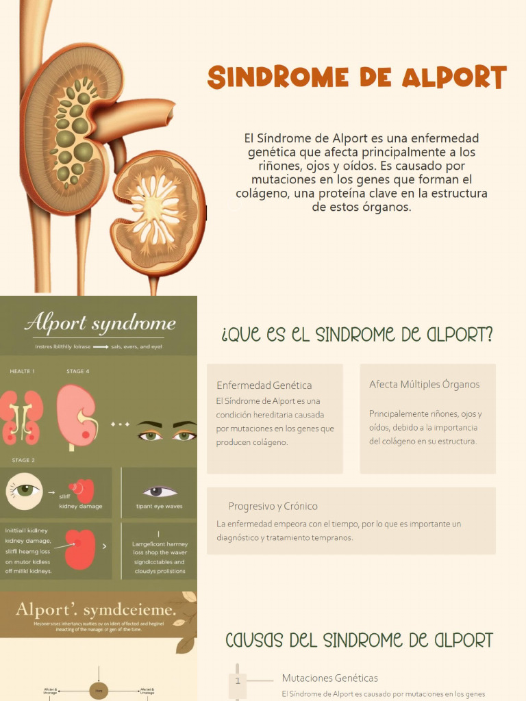 Sindrome de Alport - Sistema Renal | PDF