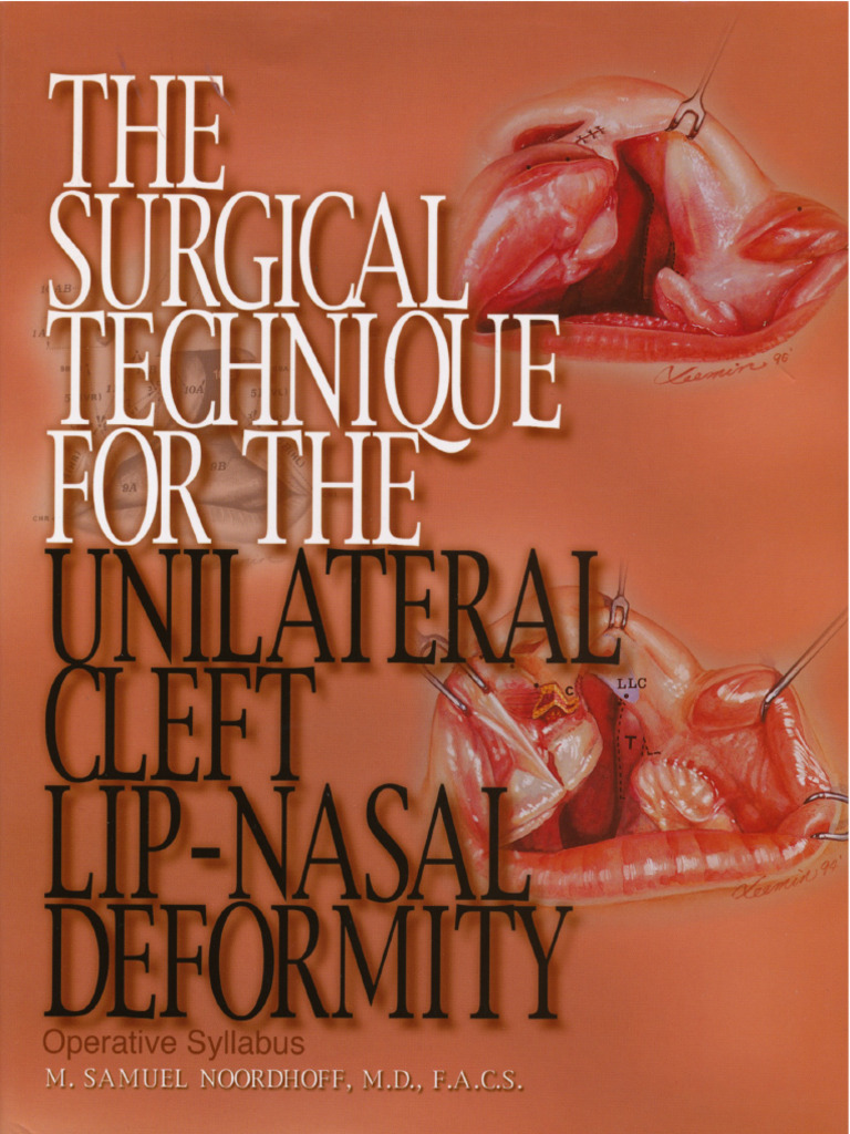 Cleft Lip Operative Syllabus-2 | PDF