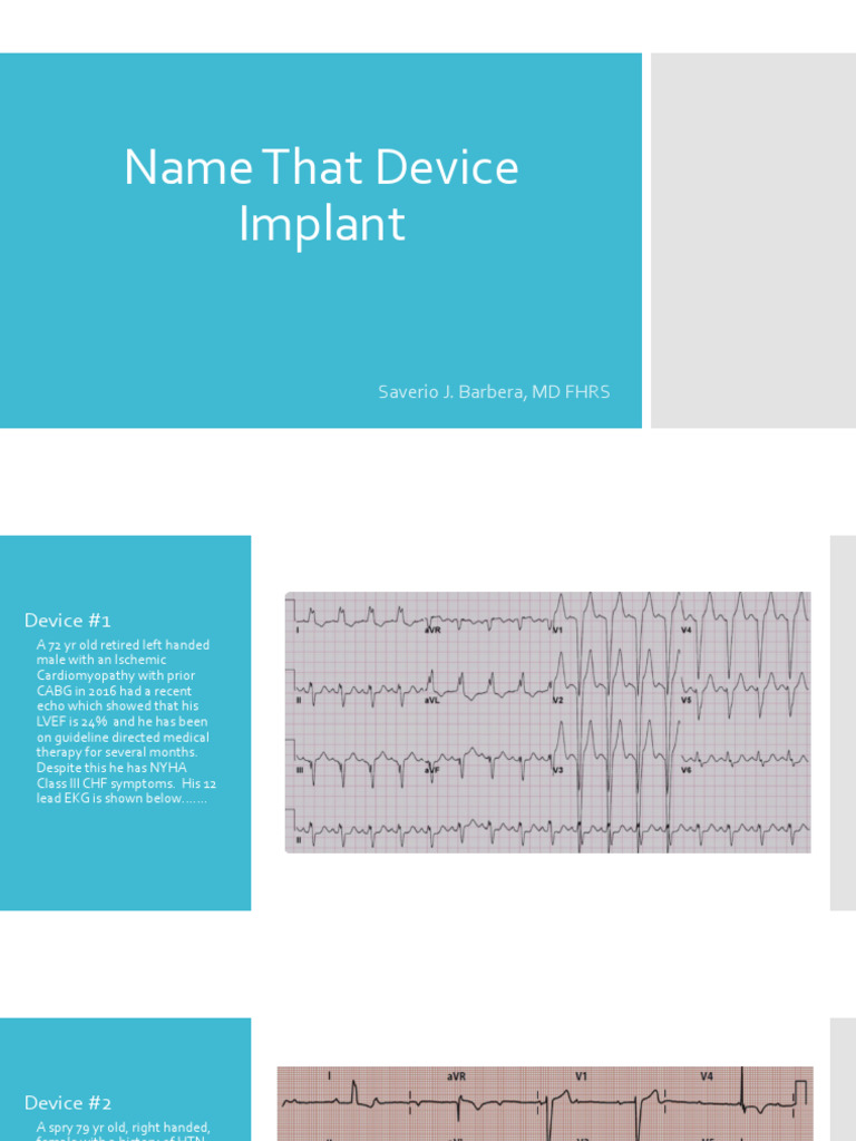Cardiac Device Case Studies Analysis | PDF | Heart | Electrocardiography