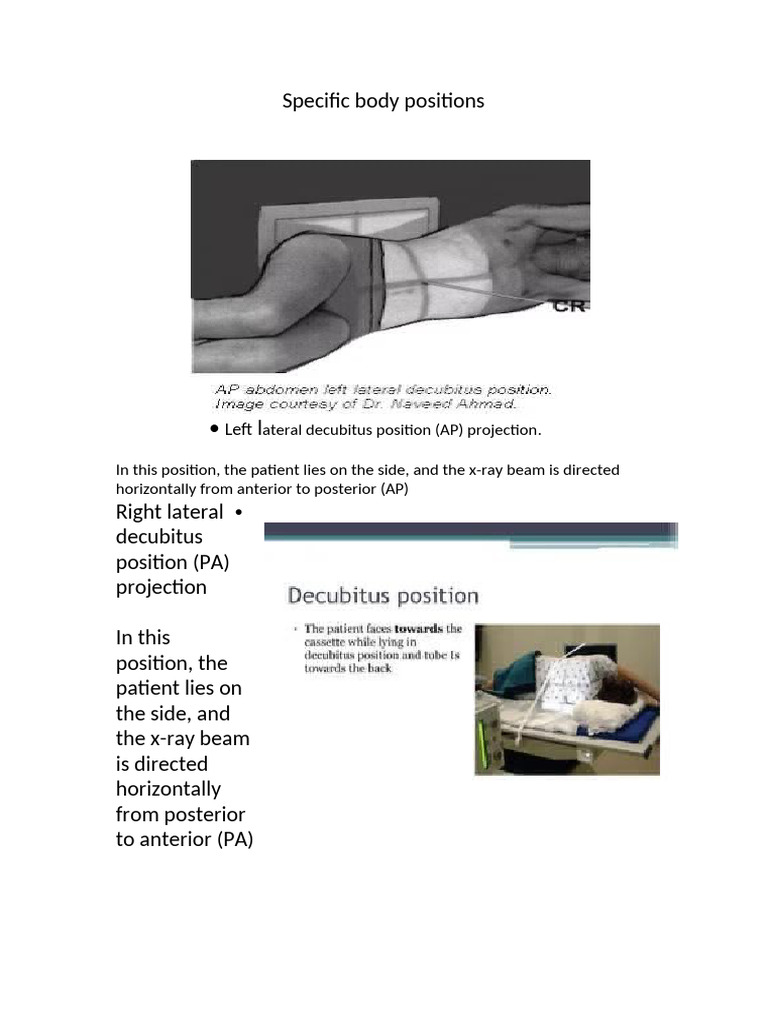 X-Ray Decubitus Positions Guide | PDF