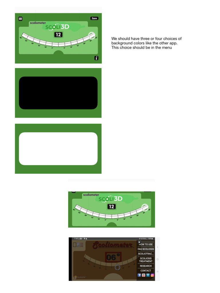 Scoliometer Diag. 1 | PDF
