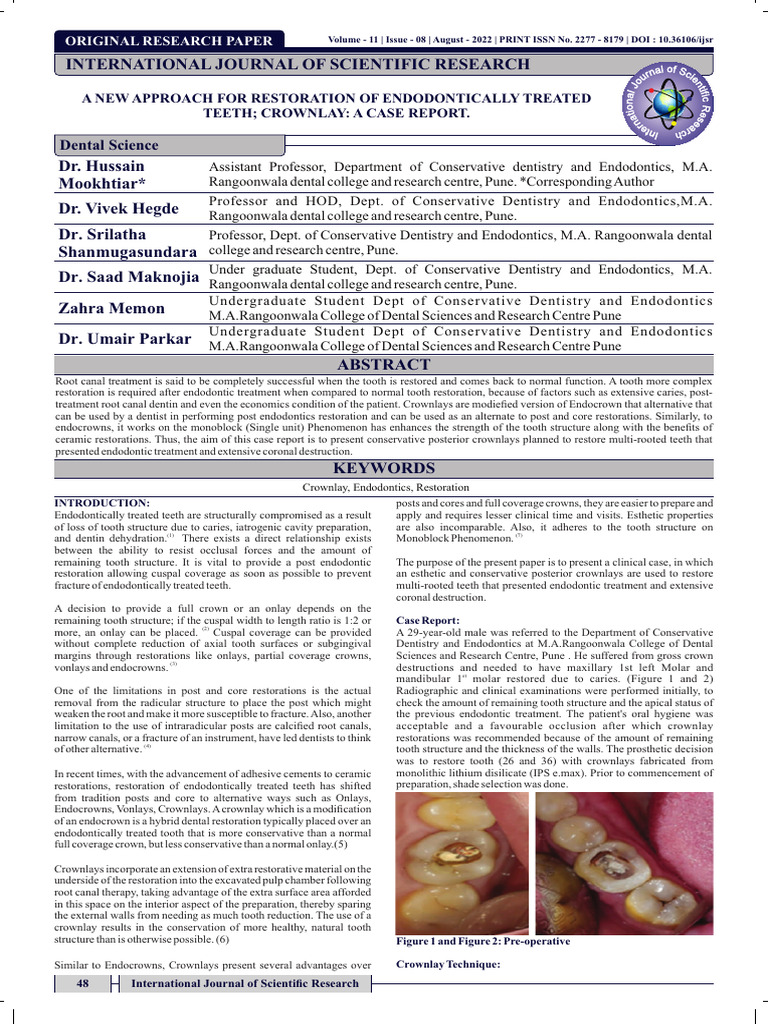Crownlay Restoration for Endodontic Teeth | PDF | Human Tooth | Mouth