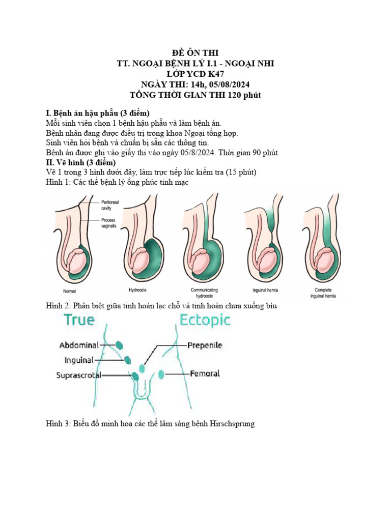 Đề ôn thi Ngoại nhi | PDF