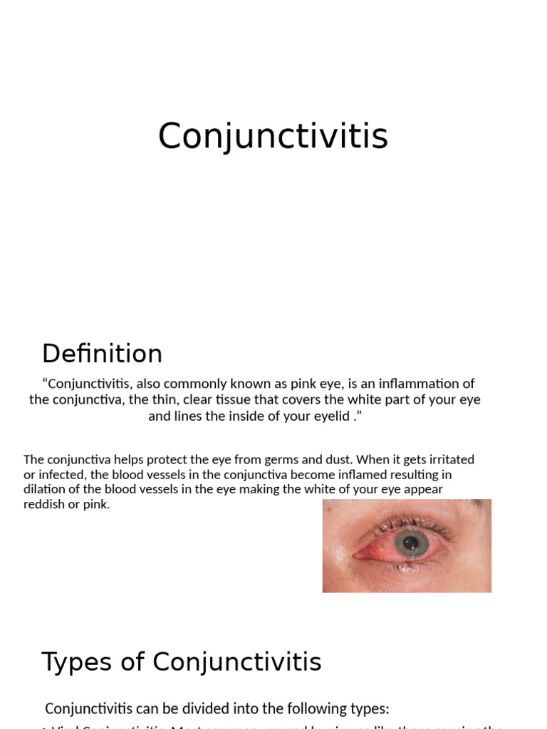 Understanding Conjunctivitis Types and Treatment | PDF | Allergy | Allergen