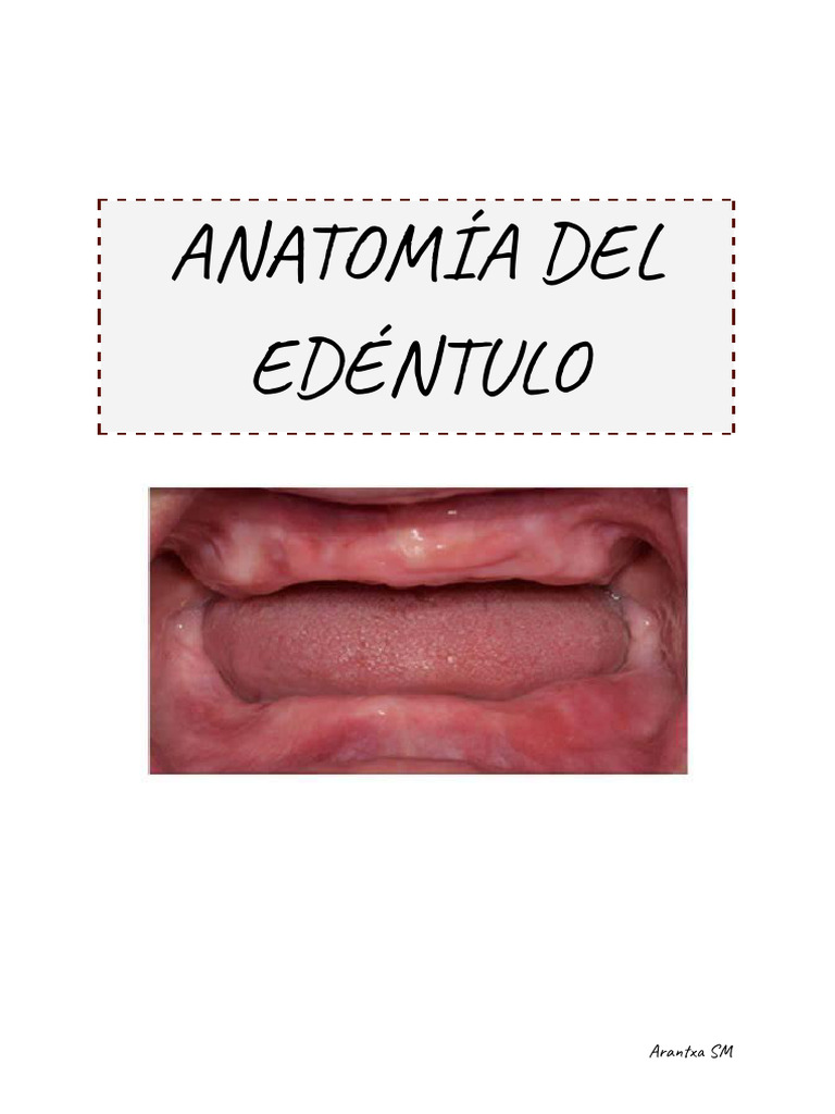 Anatomia Del Edentulo | PDF