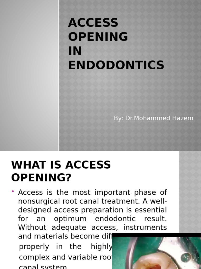 Access Openings in Endodontics | PDF | Dental Anatomy | Dentistry Branches