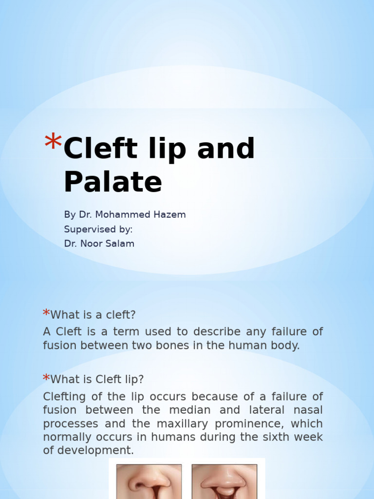 Cleft Lip and Palate | PDF | Orthodontics | Human Head And Neck
