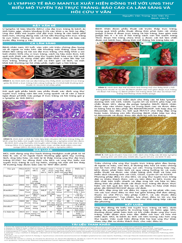 U Lympho Te Bao Mantle Va UTBM Tuyen Tai Truc Trang - Nguyen Van Trong | PDF