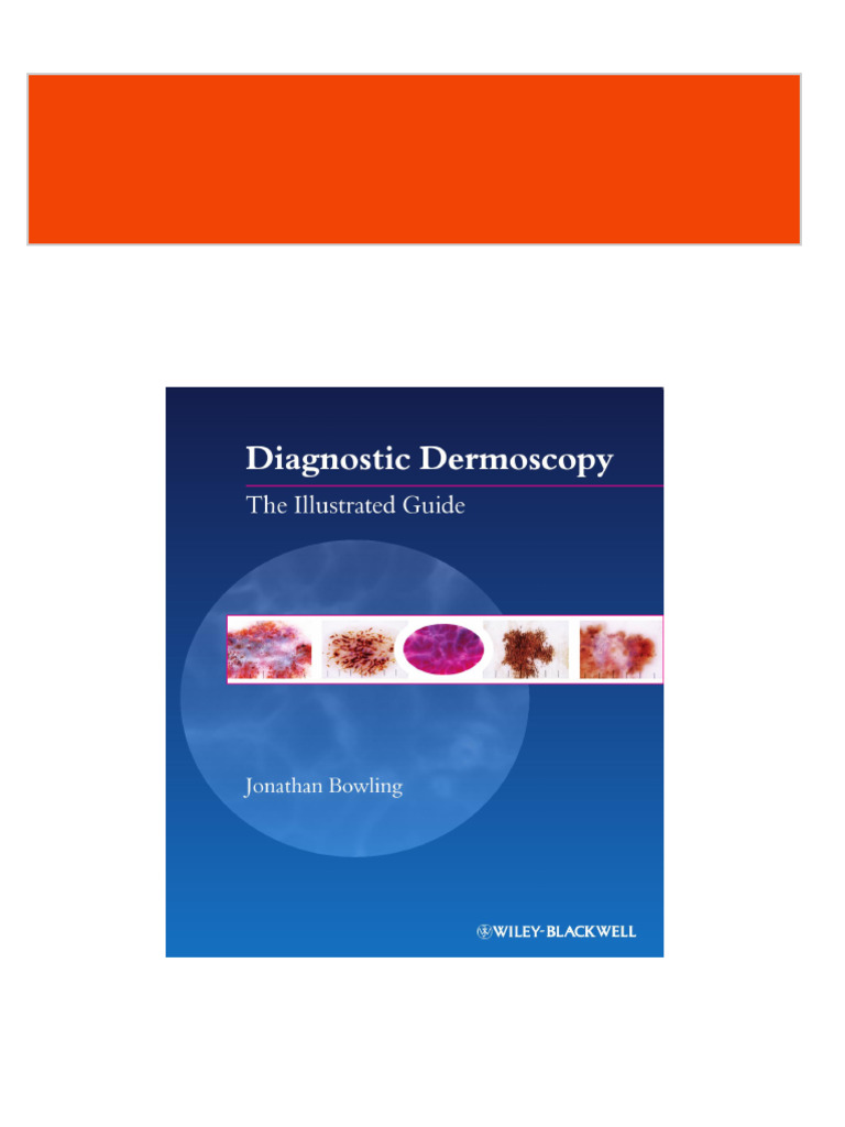PDF Diagnostic Dermoscopy The Illustrated Guide by Jonathan Bowling ...