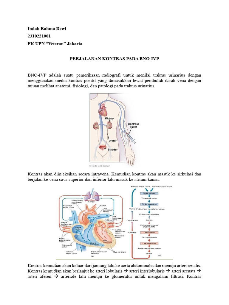 Perjalanan Kontras | PDF