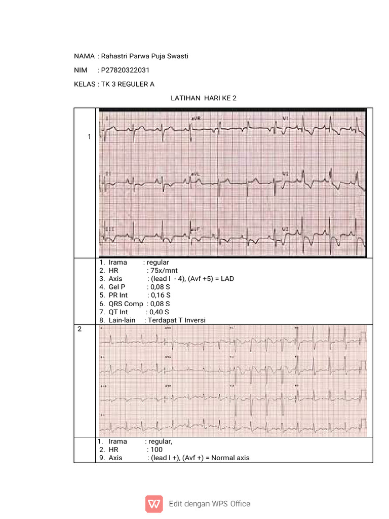 Penugasan Hari 2 | PDF