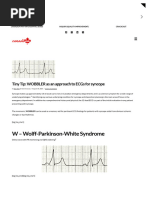 ECG Rhythm Analysis - Life in The Fast Lane ECG Library | PDF | Computers