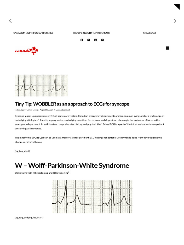 WOBBLER in ECG For Syncope | PDF | Electrocardiography | Cardiovascular ...