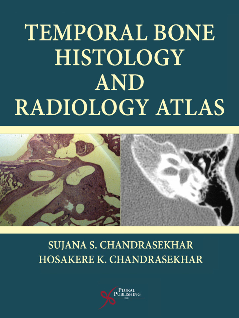 Sujana S. Chandrashekhor, Hosakere K. Chandrasekhar - Temporal Bone ...