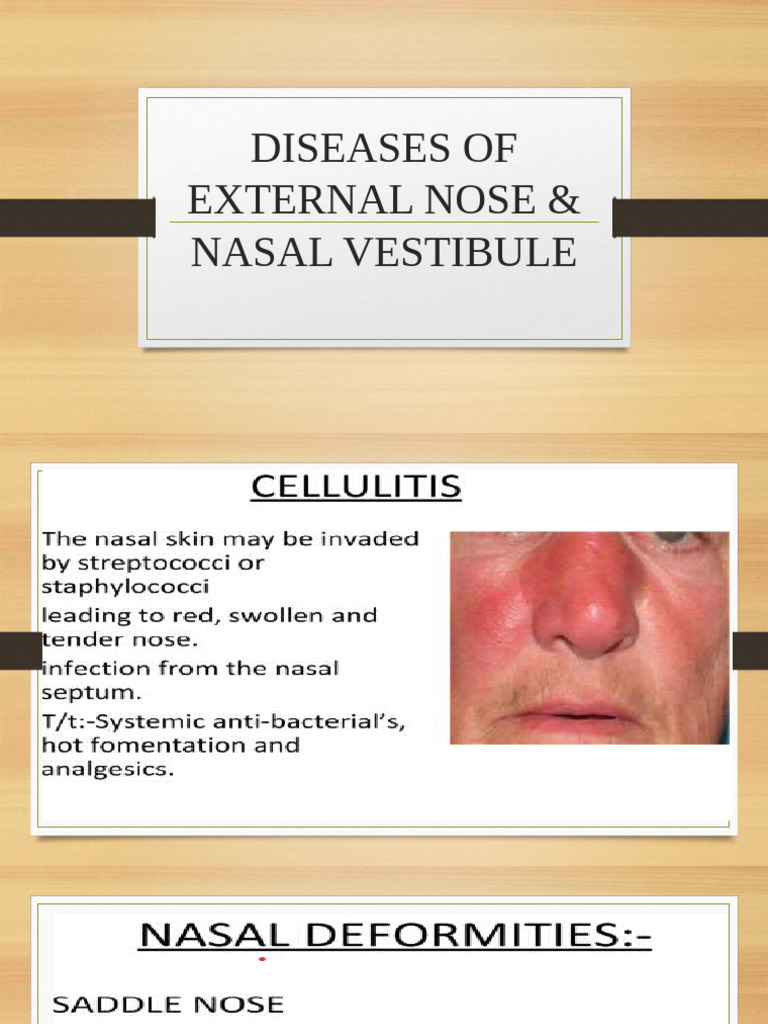 Diseases of External Nose & Vestibule | PDF