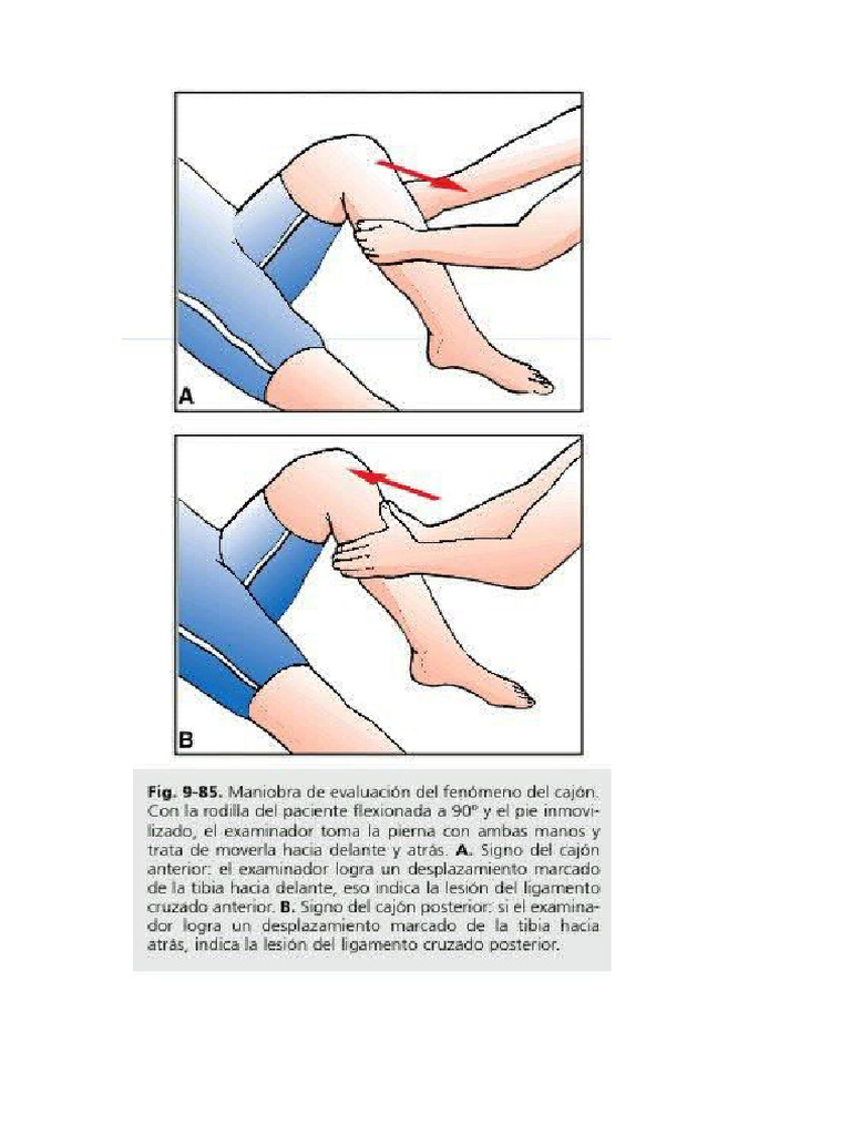 Maniobras de Evaluacion Del Cajon. Rodilla | PDF
