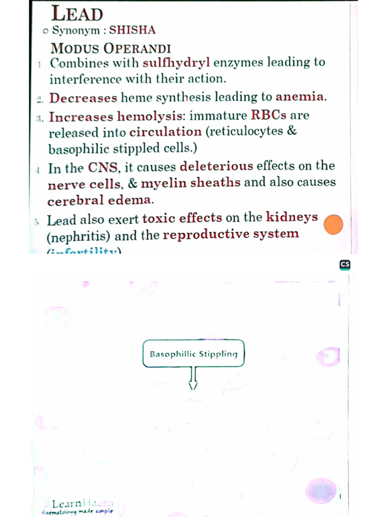 Forensic - Special Toxicology (Lead Poisoning) | PDF