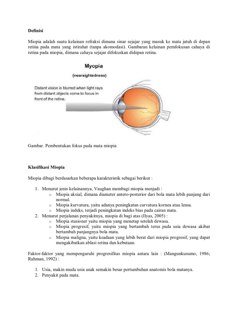 Miopi | PDF | Sains & Matematika