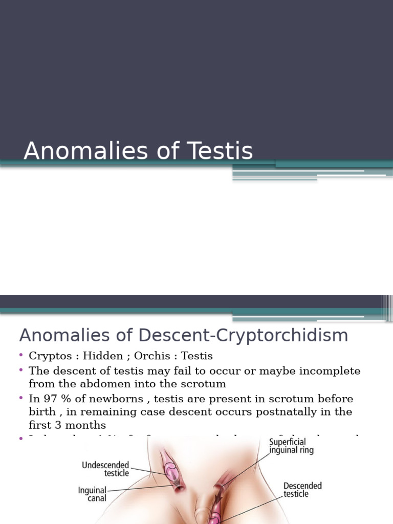 Anomalies of Testis | PDF | Testicle | Male Mammals