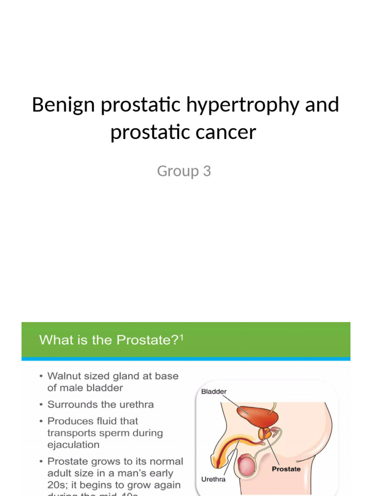 BPH and Prostate Cancer Overview | PDF | Prostate | Prostate Cancer