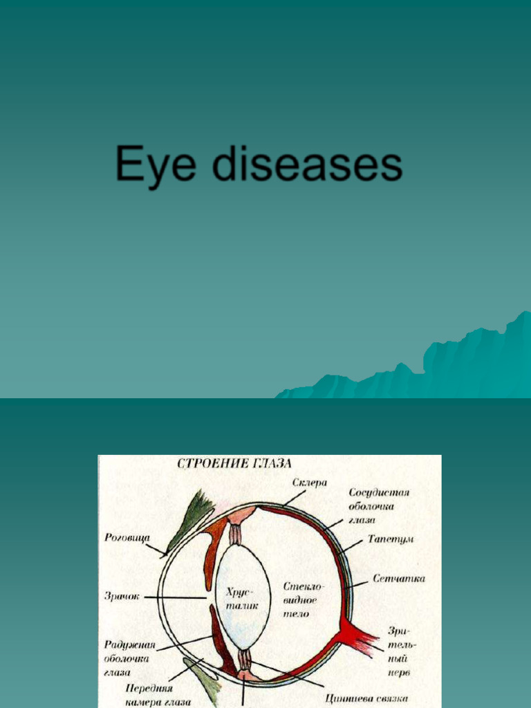 Eye Diseases | PDF | Cornea | Inflammation