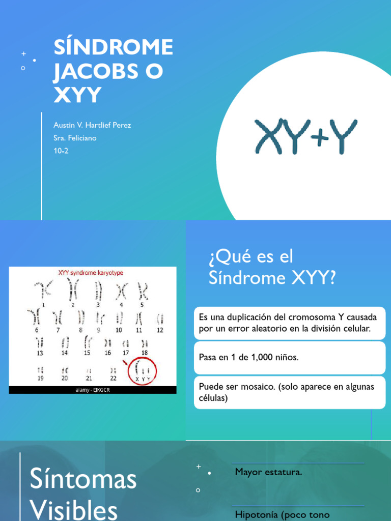 Síndrome Jacobs o XYY | PDF