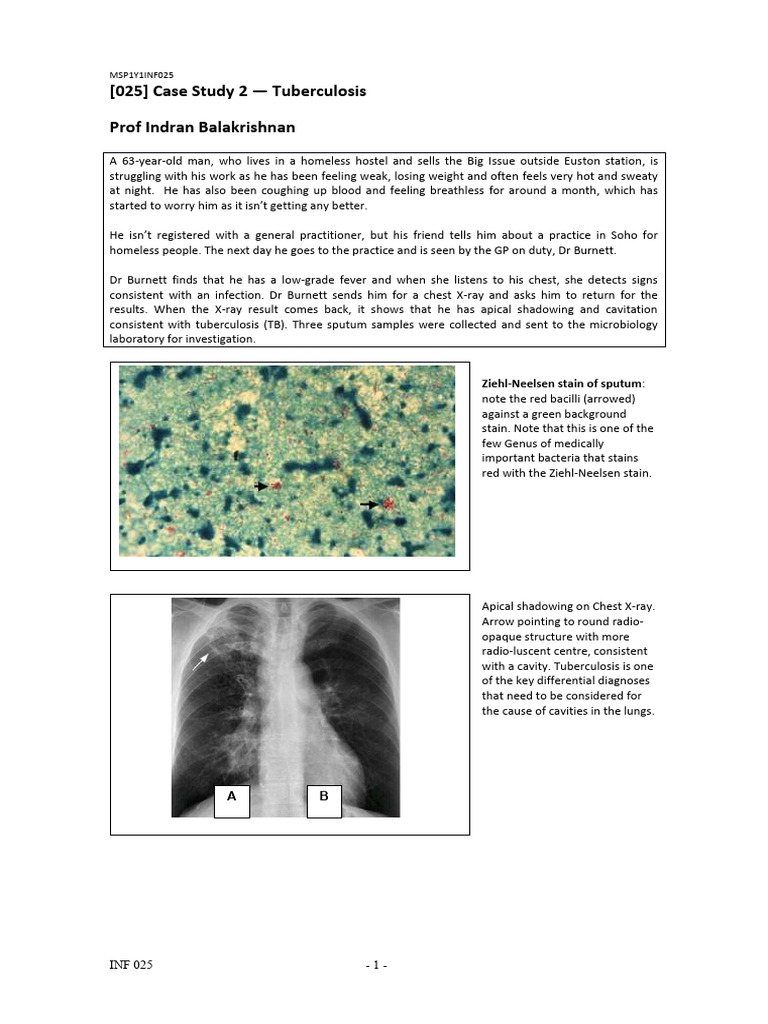 INF-025 Case Study 2 Tuberculosis - EG Edits | PDF | Tuberculosis ...