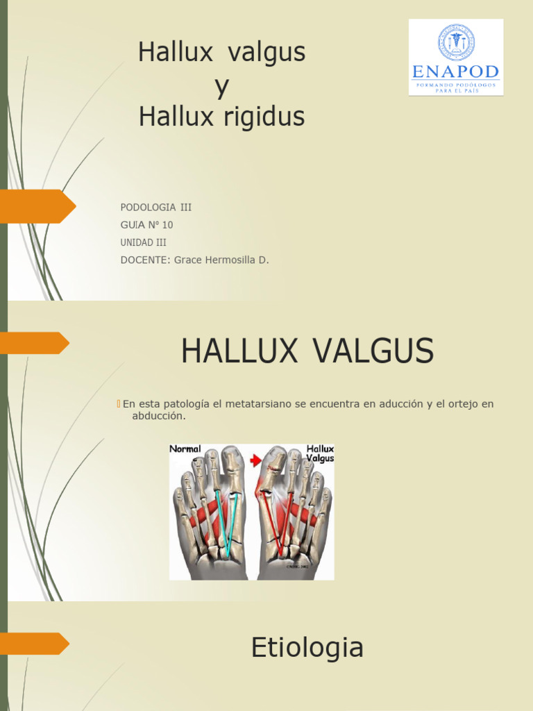 Hallux Valgus y Rigidus: Diagnóstico y Tratamiento | PDF | Dedo del pie ...